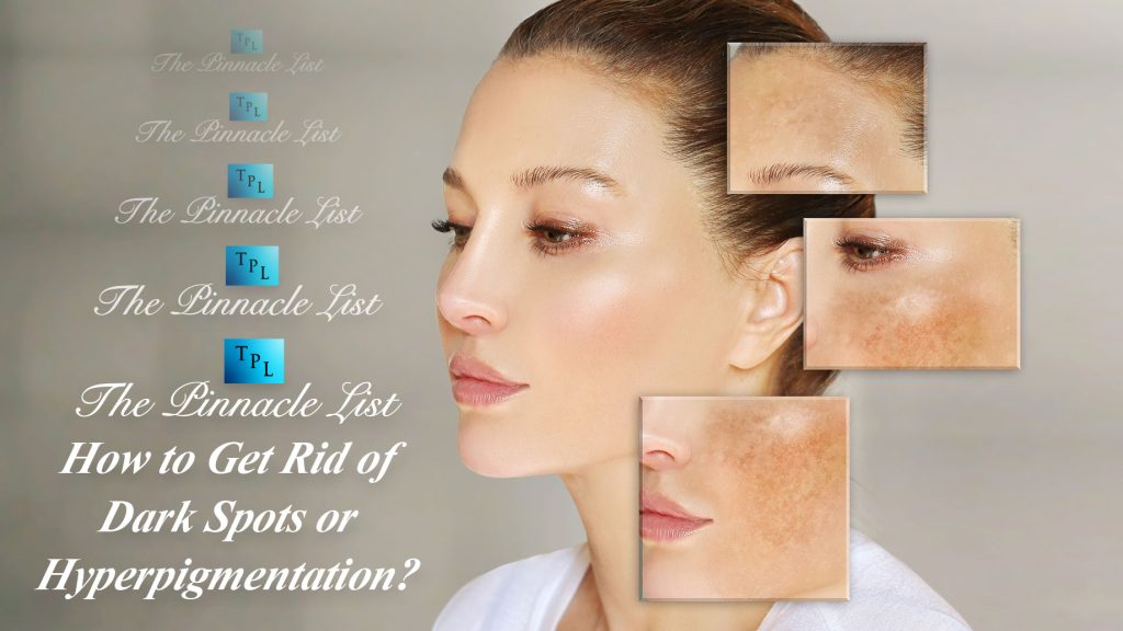 How to Get Rid of Dark Spots or Hyperpigmentation? – The Pinnacle List